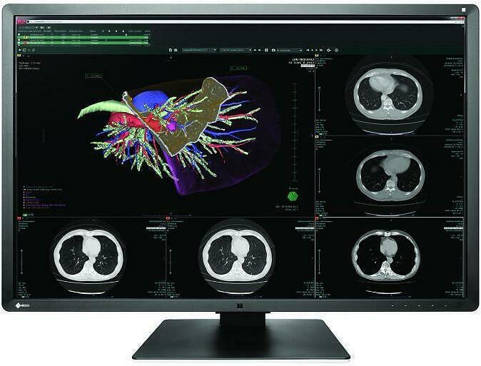 EIZO RadiForce RX660 Monitor Preturi, EIZO RadiForce RX660 Magazine