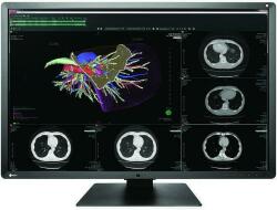 EIZO RadiForce RX660 Monitor Preturi, EIZO RadiForce RX660 Magazine